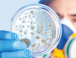 Clasificación de los Agentes Biológicos en la Salud Laboral - EUCA